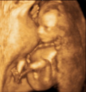 Terhesség hétről hétre - 16. hét | Családinet.hu